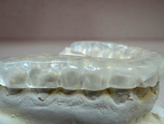 Les bienfaits de la plaque occlusale | Denturologiste Clinique Cloutier ... Les bienfaits de la plaque occlusale | Denturologiste Clinique Cloutier ...